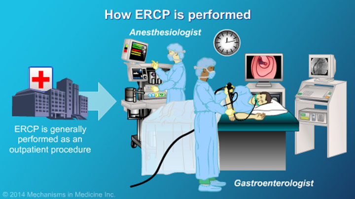 Understanding ERCP