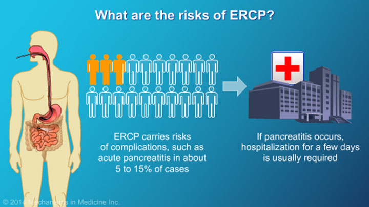 Understanding ERCP