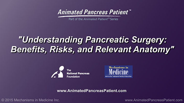 Whipple Procedure Animation